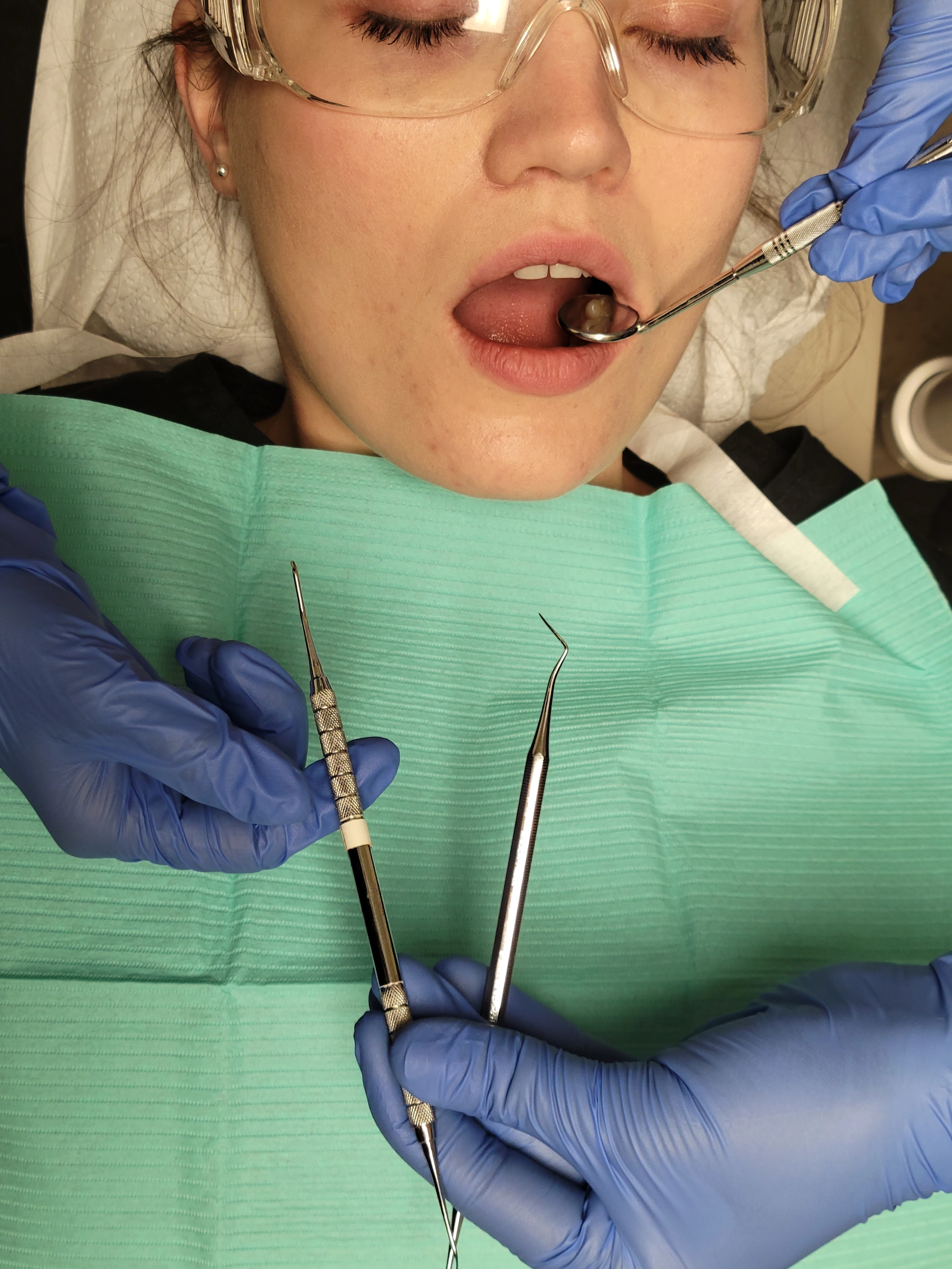 The Single-handed Transfer - The Concepts of Four-handed Dentistry ...