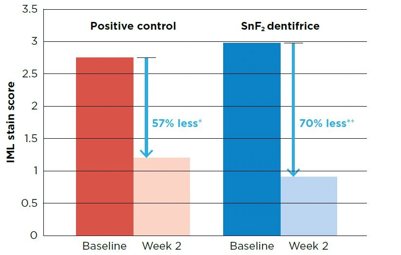 Anti-Stain and Whitening - Stannous Fluoride Toothpaste | Dentalcare