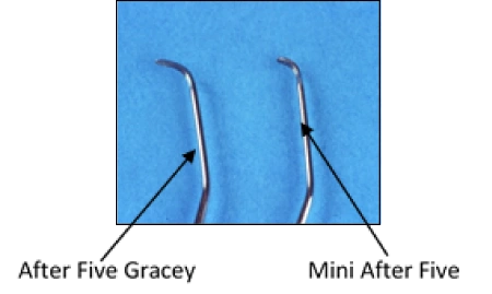 After Five, Mini Five and Micro Mini Gracey Curettes - Advanced ...