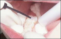 Step Six – Apply the Sealant Material | Sealants: The Added Link in ...