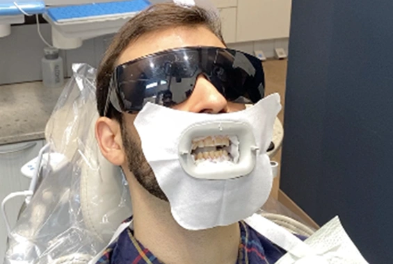 In Office Treatment | How Whitening Works | Continuing Education Course ...
