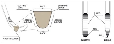 Working End - Advanced Instrumentation for the General Practice Dental ...