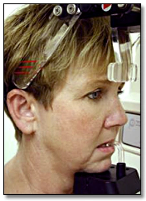 Patient Positioning and Exposure - Practical Panoramic Imaging - Dentalcare