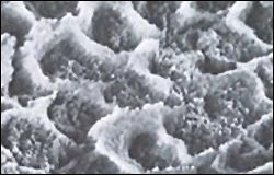 Step Four – Rinse and Dry the Tooth Surface | Sealants: The Added Link ...