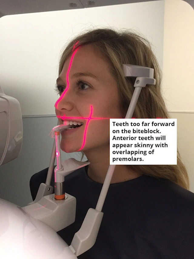 Causes and Appearance of Errors in Technique - Panoramic Radiographs ...