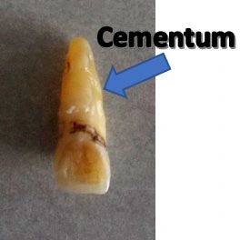 Terms A-C - Oral Health Care: A Whole New Language - Dentalcare