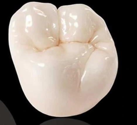 Types of Materials Used in Esthetic Restorations - Care & Maintenance ...