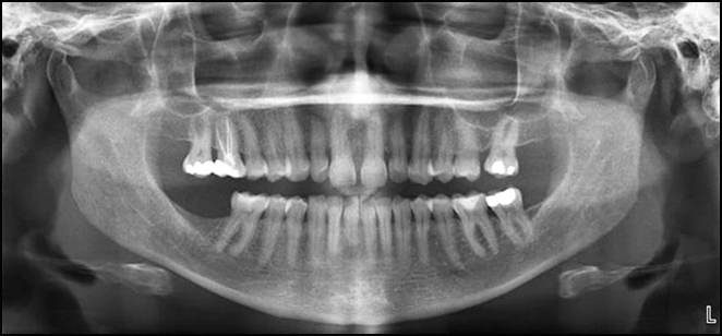 Image Evaluation - Practical Panoramic Imaging - Dentalcare
