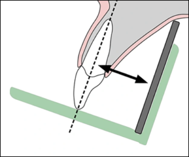 Principles of Accurate Image Projection - Intraoral Imaging: Basic ...