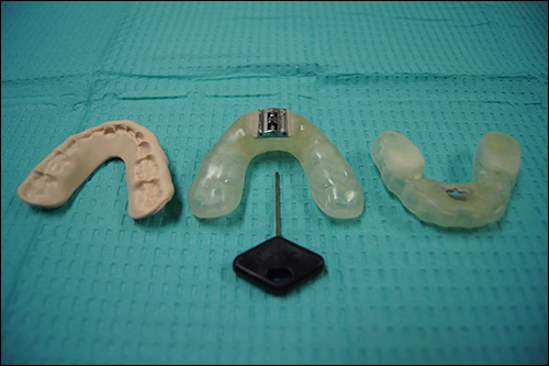 Delivery of the MAD - Sleep Apnea Management for the Dentist - Dentalcare