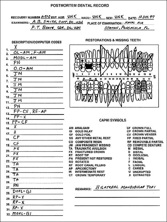 Identification and Methods Utilized - Forensic Dentistry - Dentalcare