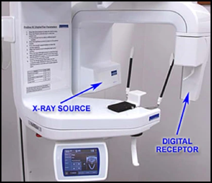 X-ray Source and Other Factors - Practical Panoramic Imaging - Dentalcare