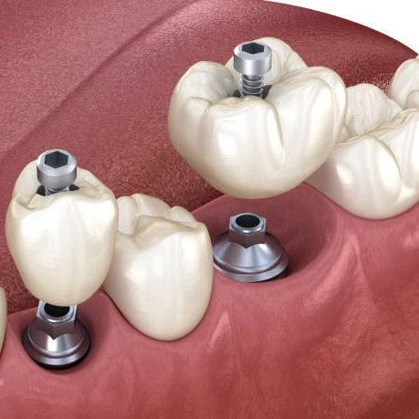 Dental Care Information for Professionals | Dentalcare.com