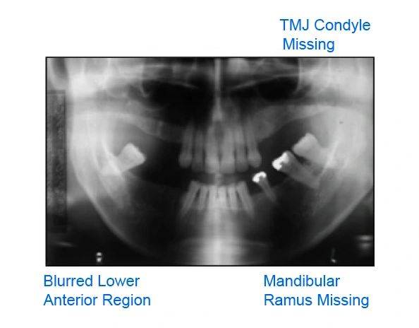 Image Evaluation - Practical Panoramic Imaging - Dentalcare