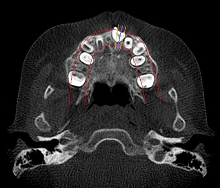 Cone Beam Computed Tomography (CBCT) - Radiographic Techniques for the ...