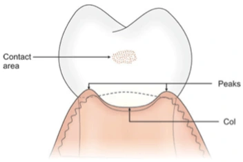 Terms A-C - Oral Health Care: A Whole New Language - Dentalcare