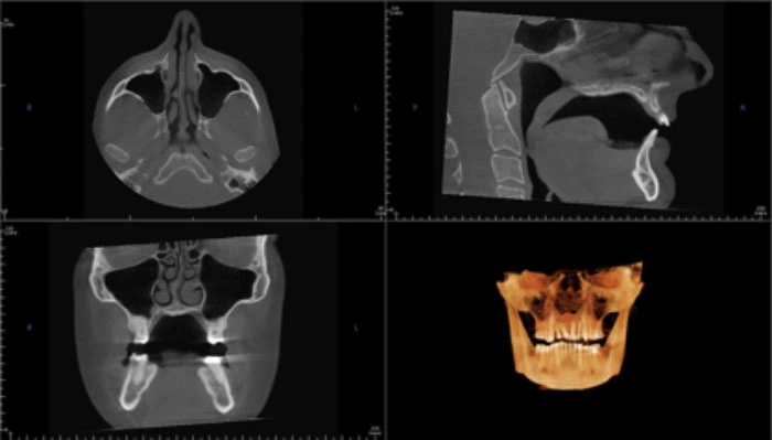 Image Acquisition and Reconstruction - Cone-Beam Computed Tomography ...