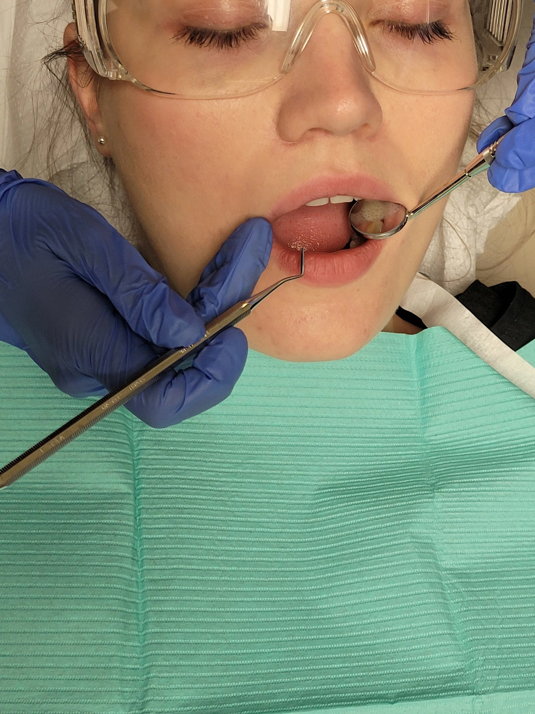 Operator Responsibilities - The Concepts of Four-handed Dentistry ...