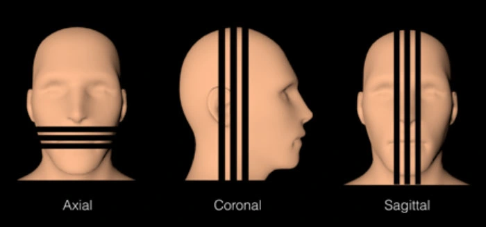 Image Acquisition and Reconstruction - Cone-Beam Computed Tomography ...