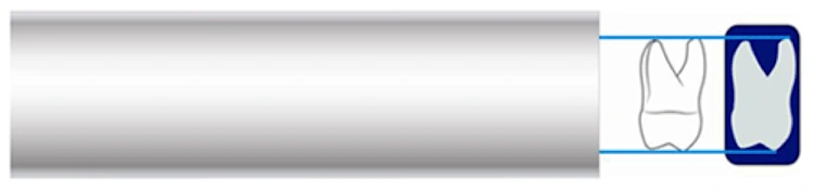 Principles of Accurate Image Projection - Intraoral Imaging: Basic ...