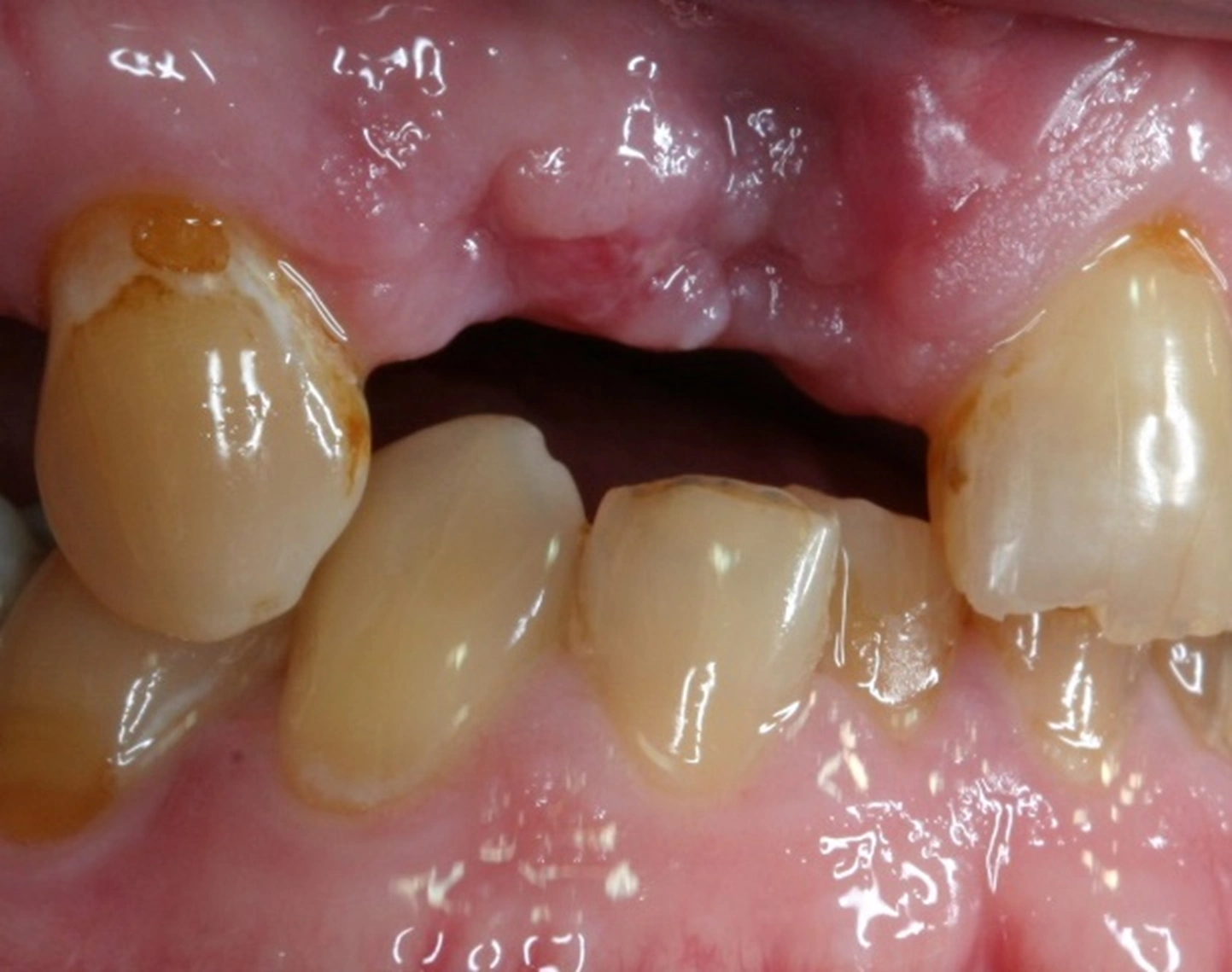 Assessment of the Hard and Soft Tissues | Biologically Contoured ...