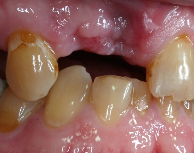 Assessment of the Hard and Soft Tissues | Biologically Contoured ...