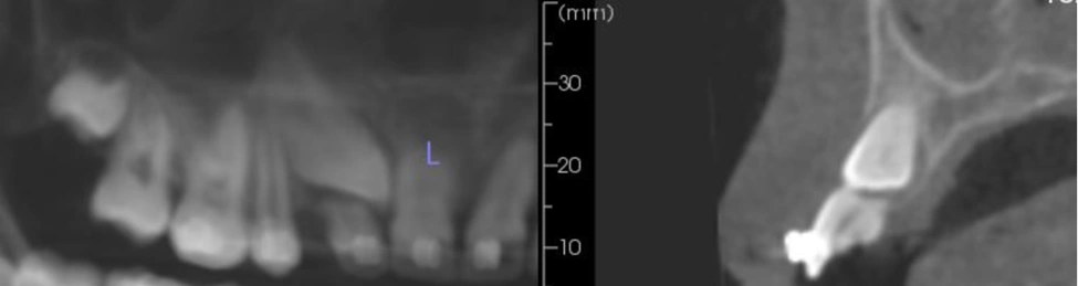 Orthodontics - Cone-Beam Computed Tomography (CBCT) Applications in ...