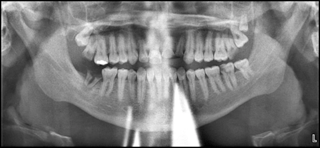 Stepwise Approach to Panoramic Technique Assessment - Practical ...