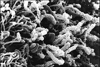 The Evolution of Plaque Hypotheses in Periodontal Disease Progression ...
