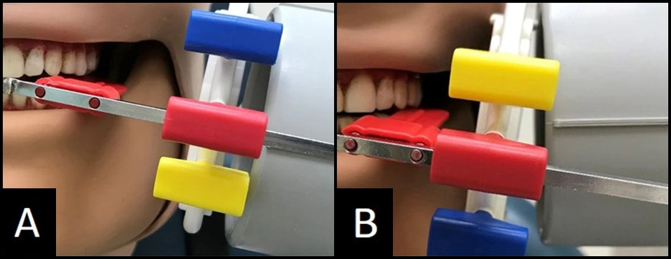 Problem #4: Bitewing Images Not Ideal | Intraoral Imaging Techniques ...