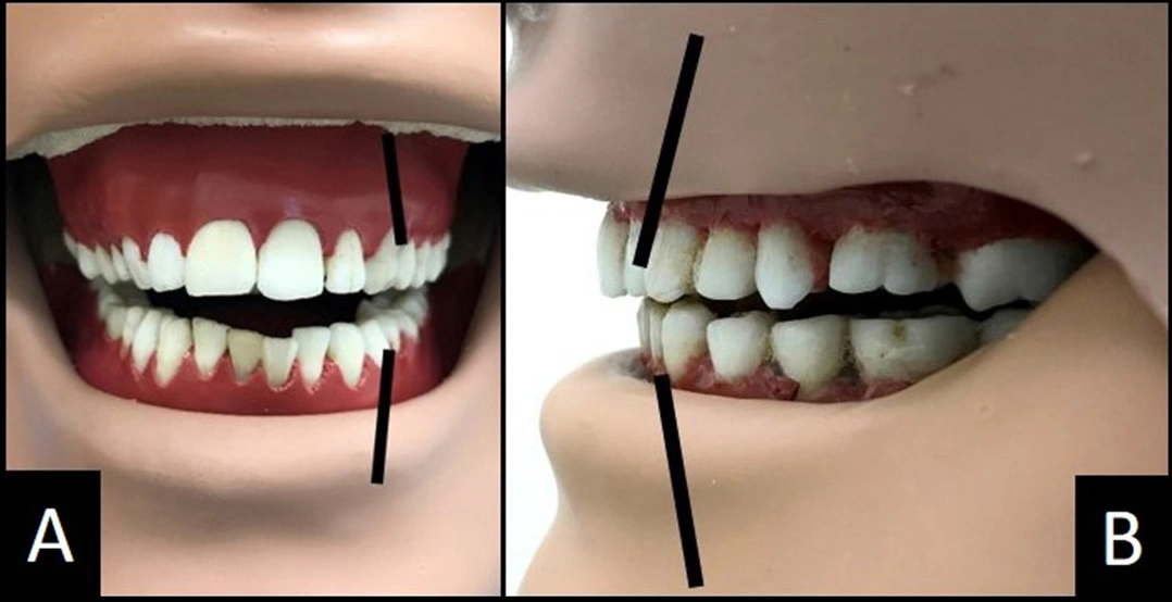The Intraoral Examination | Intraoral Imaging Techniques: Beyond the ...