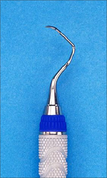 15/16 and 17/18 Gracey Curettes - Advanced Instrumentation for the ...