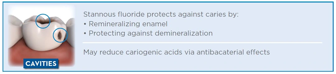 Dental Caries Treatment - Stannous Fluoride Toothpaste | Dentalcare