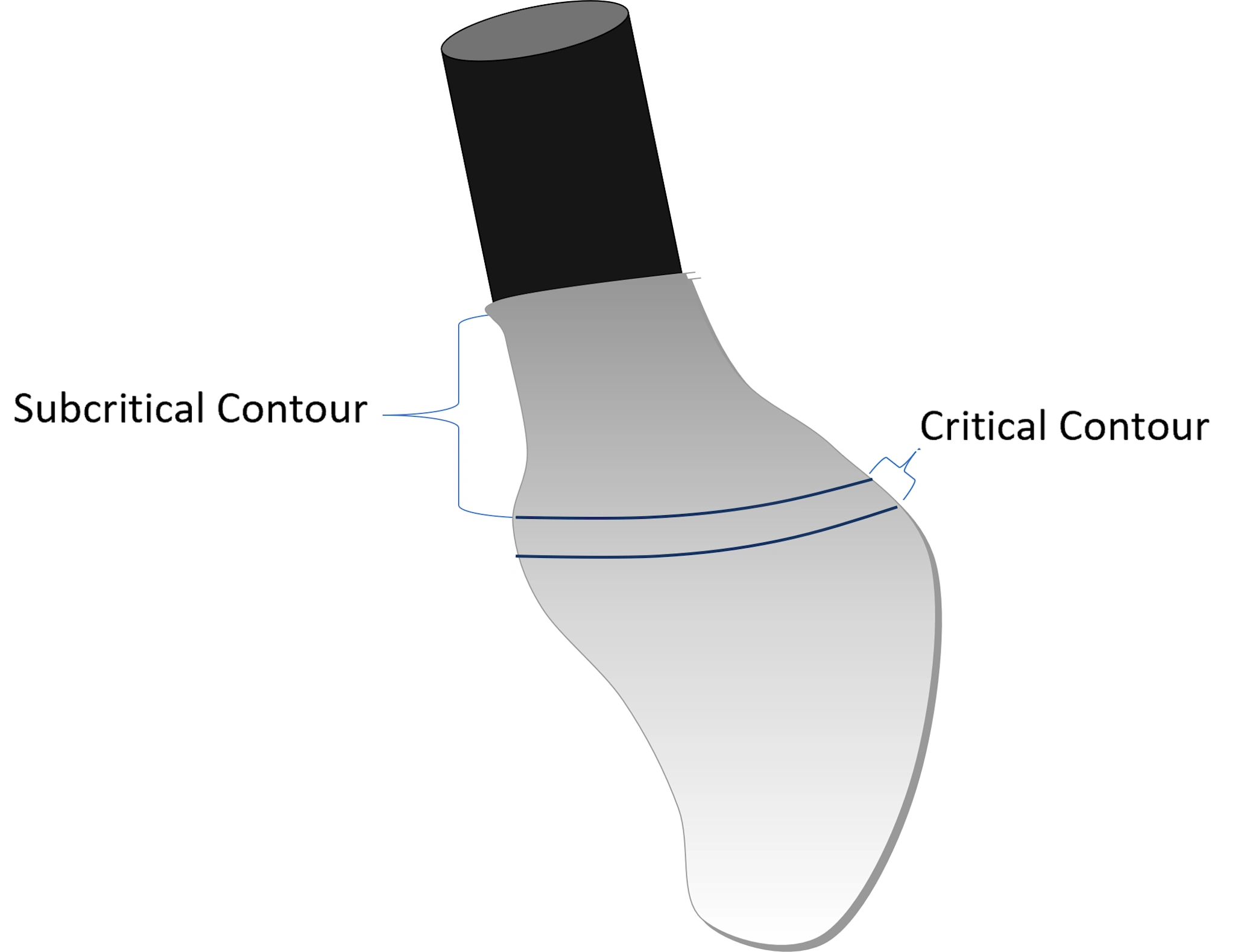 Emergence Profile | Biologically Contoured Esthetic Implant ...