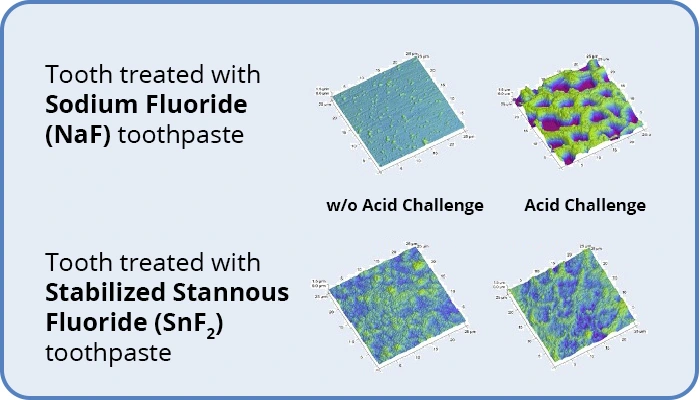Surface Layer Measurements - Managing Dental Erosion: Current ...