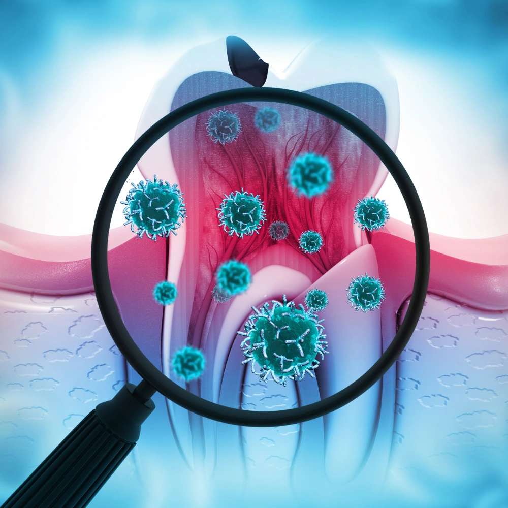 Classification of Periodontal and Peri-implant Diseases and Conditions ...
