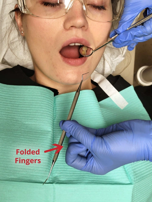 The Single-handed Transfer - The Concepts of Four-handed Dentistry ...