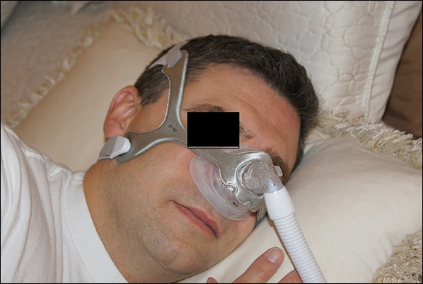 Other PAP Considerations - Sleep Apnea Management for the Dentist ...