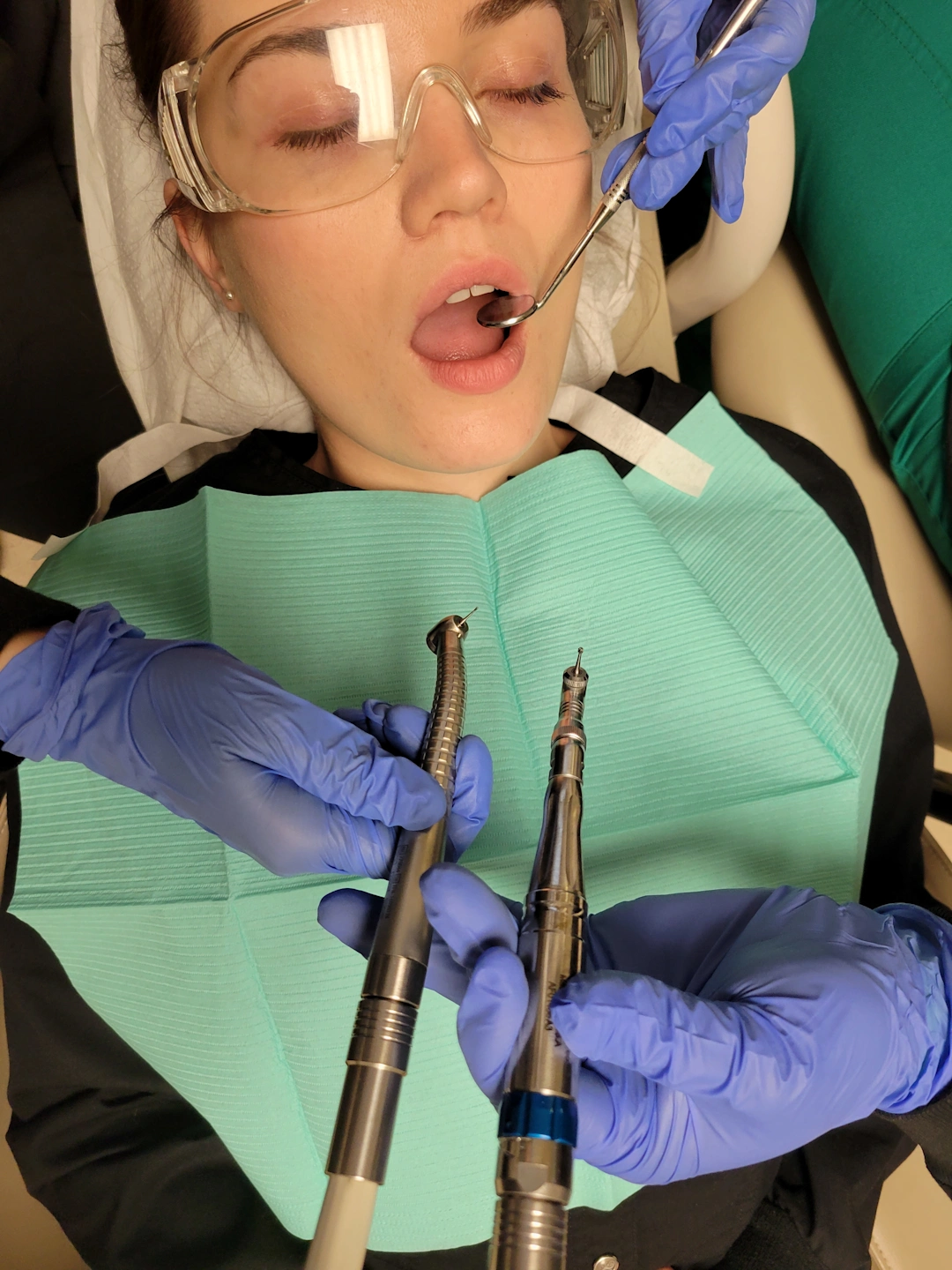 The Single-handed Transfer - The Concepts of Four-handed Dentistry ...