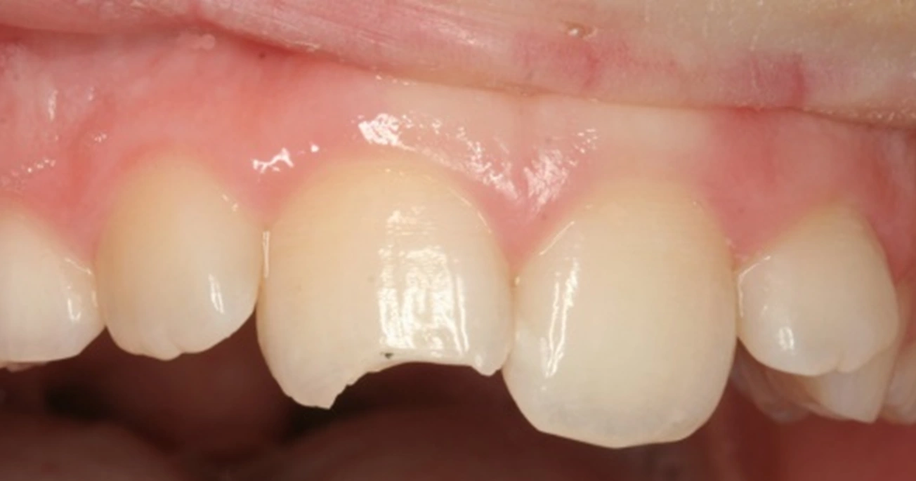 Introduction | Sports dentistry - Education and Prevention: Play it ...