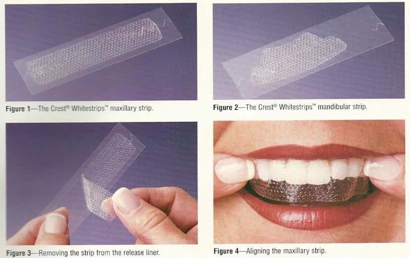 Strip Based Systems | How Whitening Works | Continuing Education Course ...