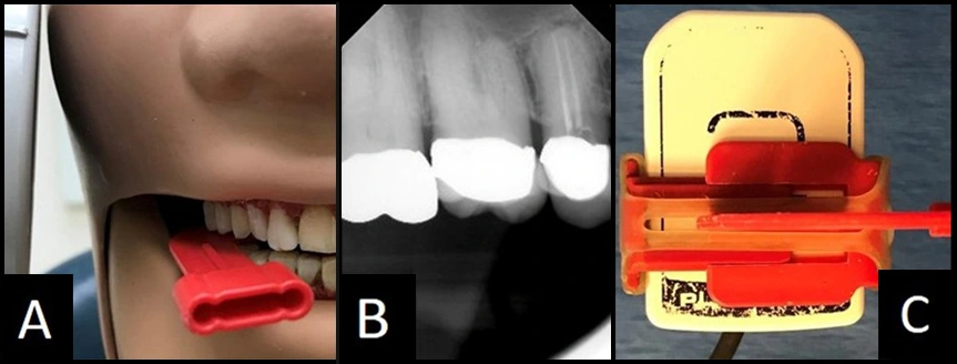 Problem #5: Comparison of periapical images versus bitewing images ...