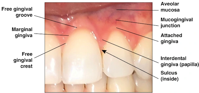 Clinical Anatomy of the Healthy Gingival Unit - Anatomy & Histology of the Gingival Unit and ...