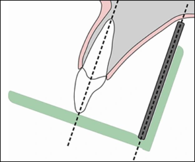 Principles of Accurate Image Projection - Intraoral Imaging: Basic ...