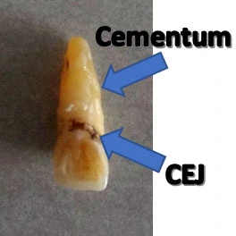Terms A-C - Oral Health Care: A Whole New Language - Dentalcare