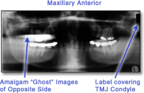 Image Evaluation - Practical Panoramic Imaging - Dentalcare