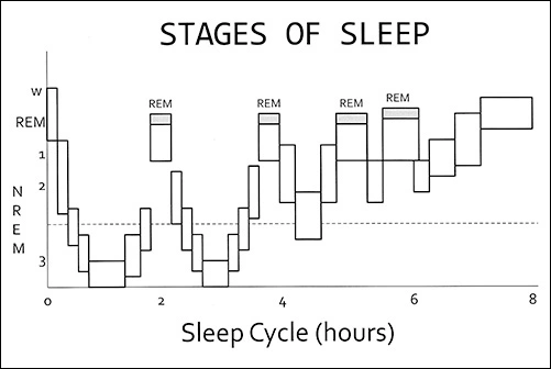 Sleep Architecture - Sleep Apnea Management for the Dentist - Dentalcare