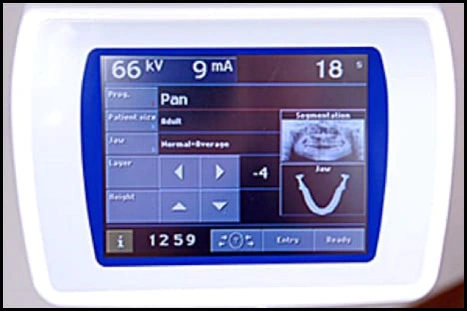X-ray Source and Other Factors - Practical Panoramic Imaging - Dentalcare