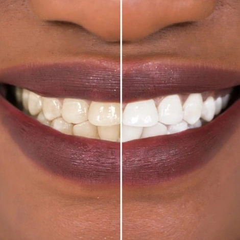 Dental Care Information for Professionals | Dentalcare.com