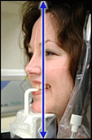 Anteroposterior Plane - Practical Panoramic Imaging - Dentalcare